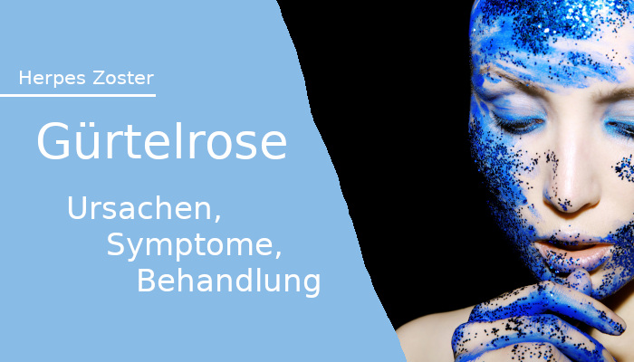 Gürtelrose (Herpes Zoster)